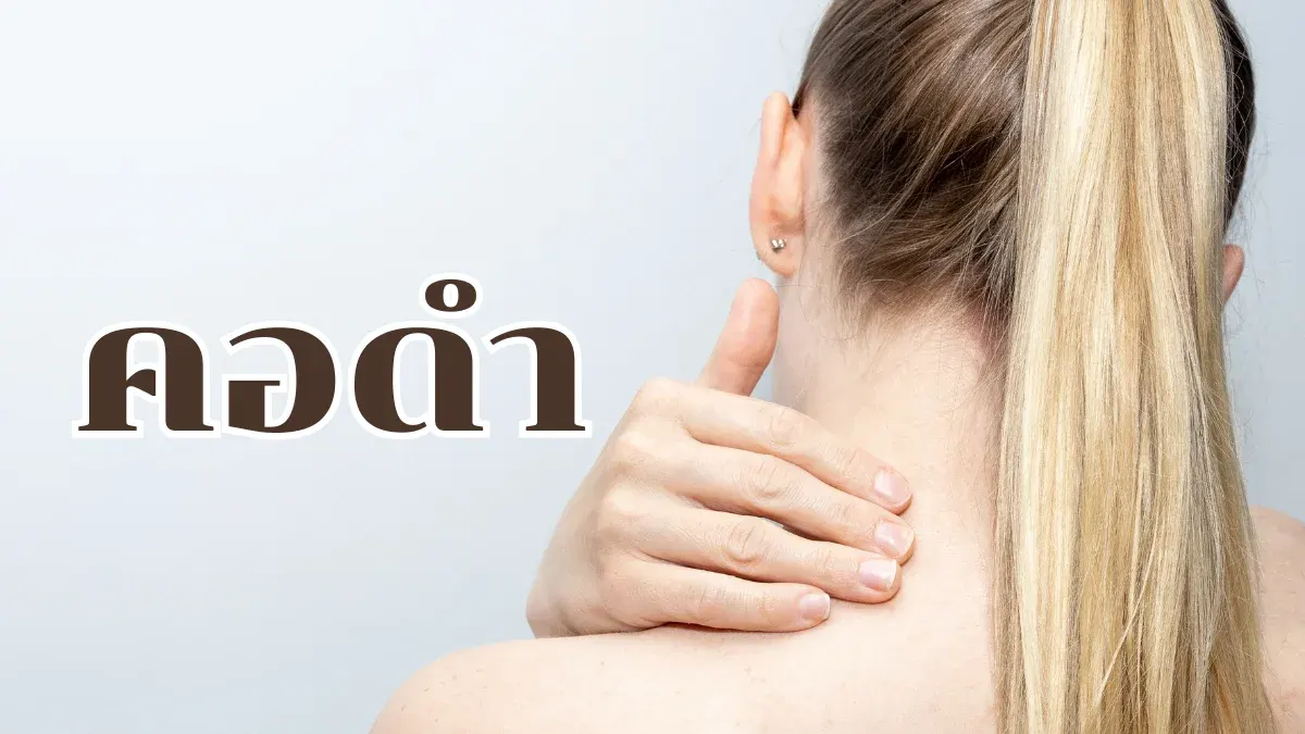 คอดำ วิธีแก้คอดำด้วยวิธีธรรมชาติ