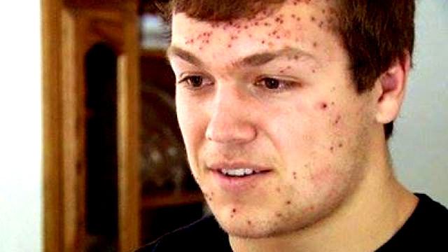 Blake Flovin นักมวยปล้ำชาวอเมริกันวัย 17 ประกาศอำลาสังเวียน หลังติด ...