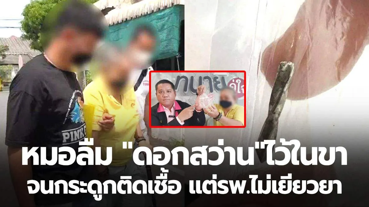 เดือดร้อนหนัก! สาวใหญ่วัย 57 เข้าร้อง "ทนายรณณรงค์" หลังหมอลืม "ดอก ...