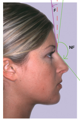 ลักษณะ จมูกสวยๆ ตามหลัก สรีระศาสตร์